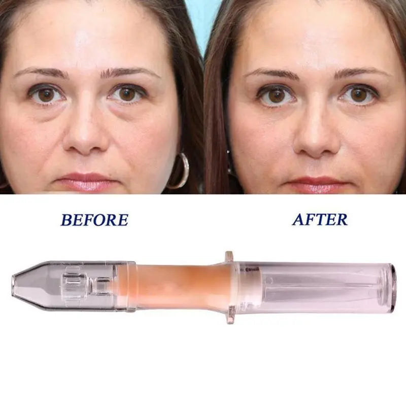 Instant Eye Bag Removal